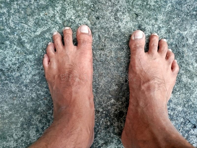 818 Man Hairy Chest Stock Photos - Free & Royalty-Free Stock Photos ...