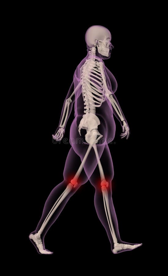 Medical Skeleton of an Overweight Woman Running Stock Illustration ...