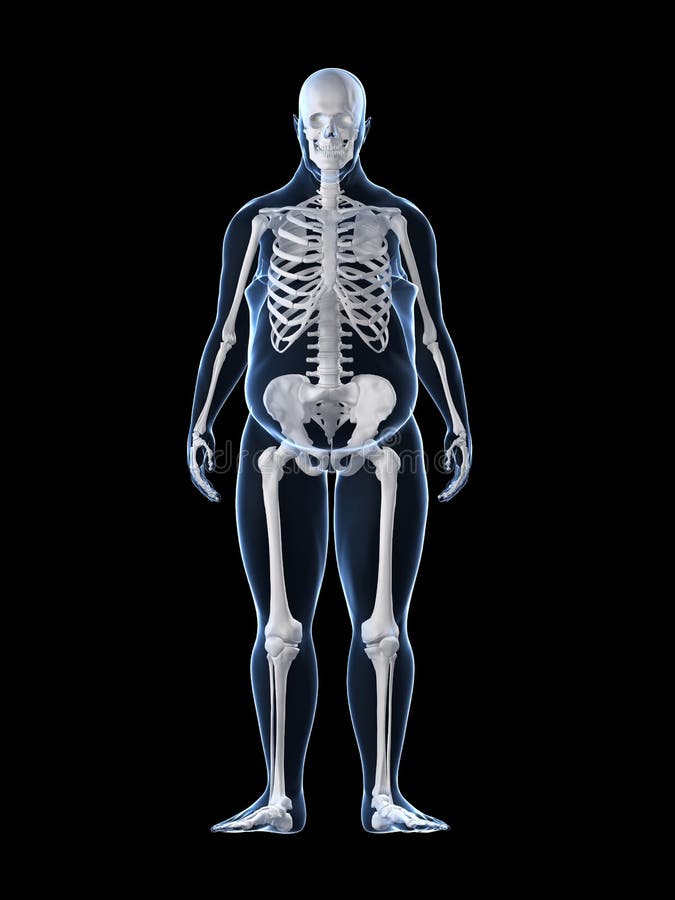 Overweight Woman - Painful Joints Stock Illustration - Illustration of ...