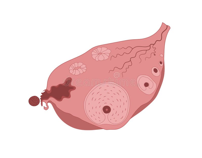 Ovulation Steps Infographic Diagram, Ovarian Cycle, Anatomy of Female ...