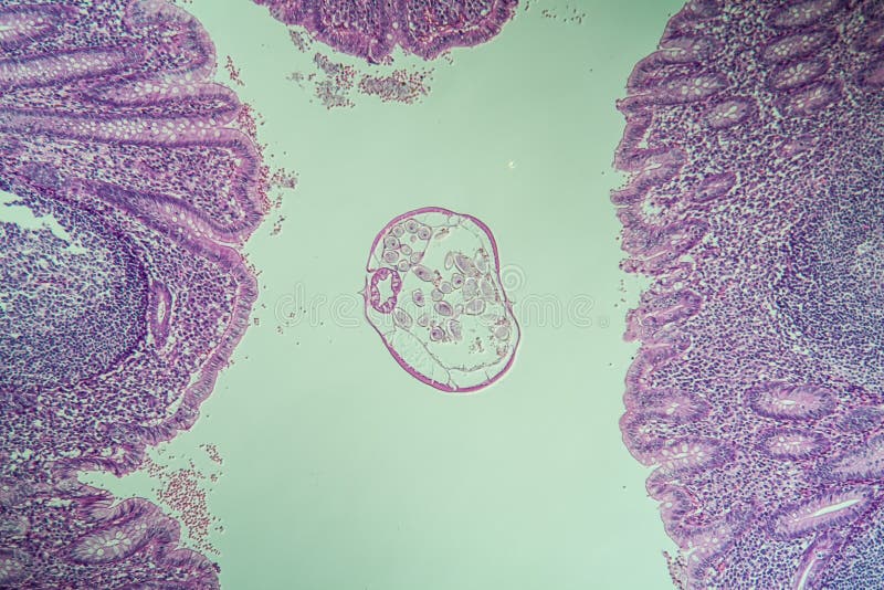 Oxiuris Pinworm Na Microscopia Intestinal Imagem de Stock - Imagem de ...