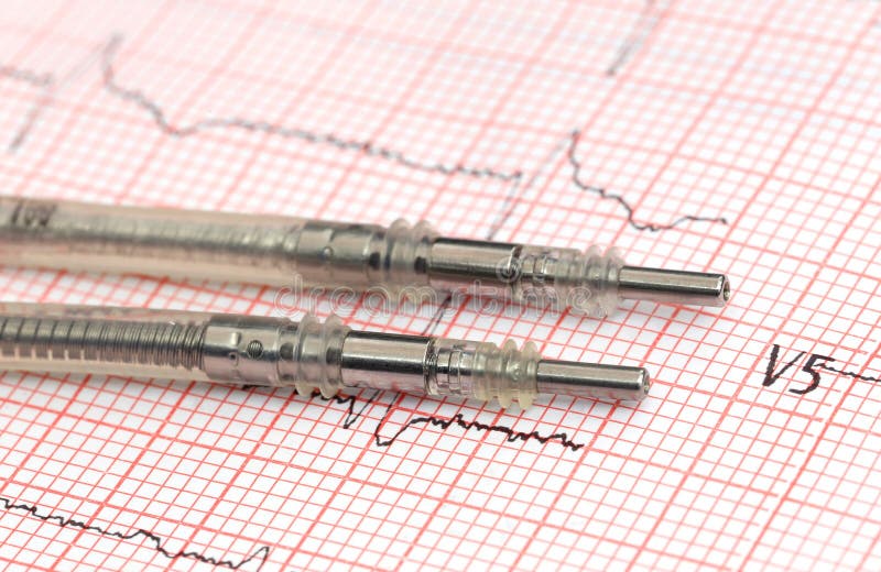 Pacemaker Leads on Electrocardiograph Stock Photo - Image of ...