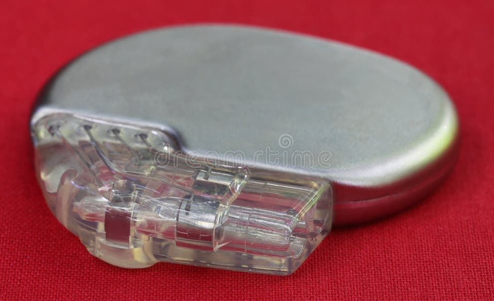 Pacemaker stock photo. Image of pulse, pace, human, medical - 44334990