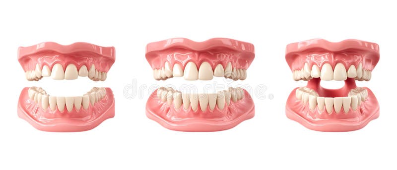 Pack of Teeth during Dental Procedures Set Against Transparent ...