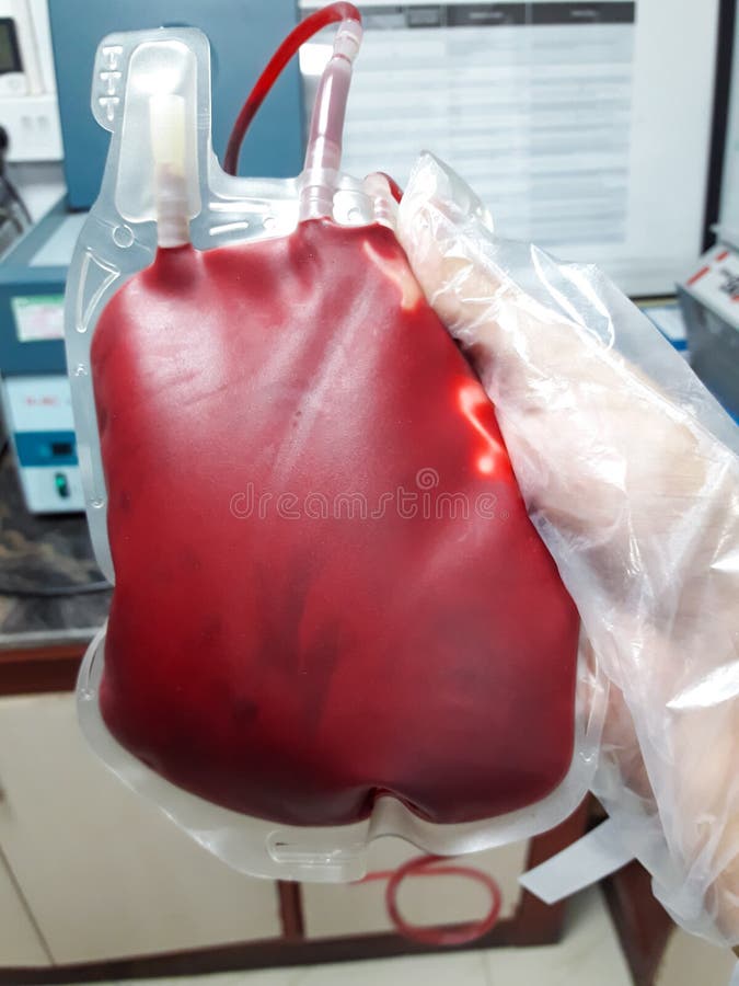 Packed Red Blood Cell in a Blood Bag Stock Photo - Image of negative ...