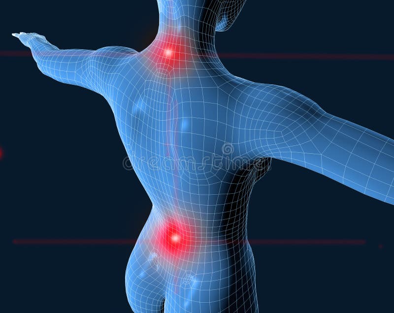 Lower Back Pain stock illustration. Illustration of physical - 23527285