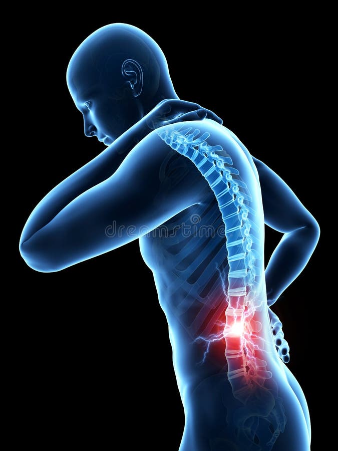 Pain in the back stock illustration. Illustration of science - 38958615