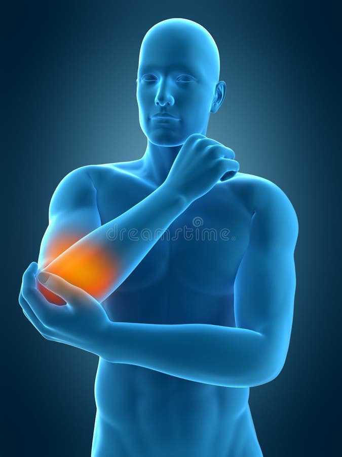 Elbow pain stock illustration. Illustration of anatomical - 74187632