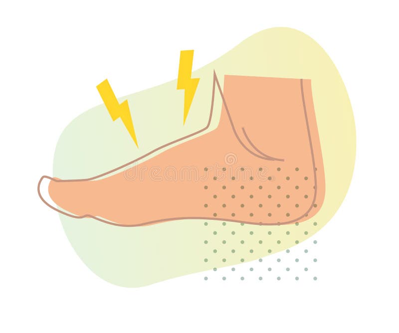 Numbness Feet Stock Illustrations – 38 Numbness Feet Stock ...