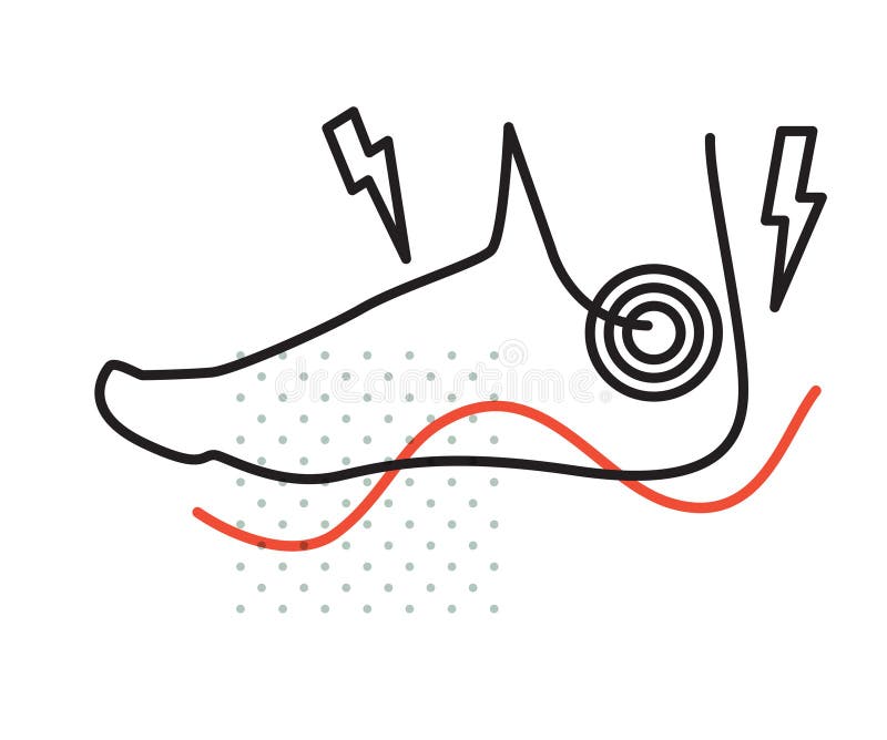 Numbness Feet Stock Illustrations – 38 Numbness Feet Stock ...