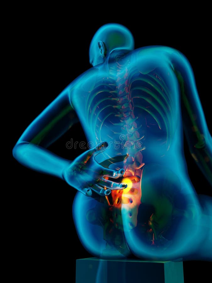 Pain stock illustration. Illustration of pain, render - 258101477
