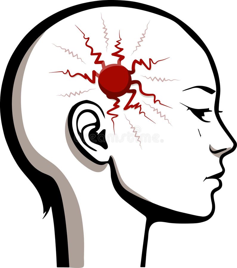 Pain in the Head, Brain and Synapses, Cognitive Problems, Mental ...