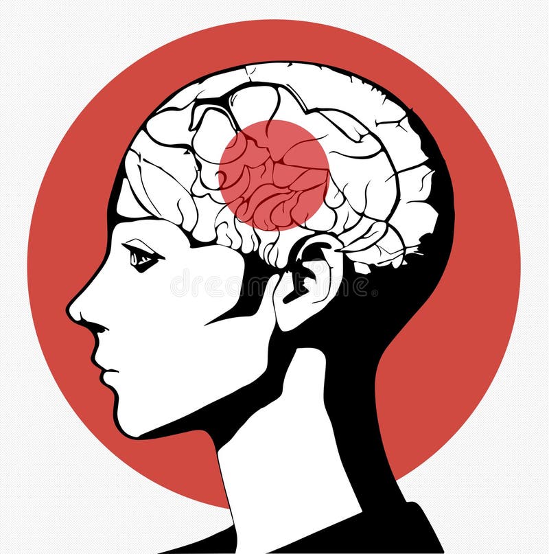 Pain in the Head, Brain and Synapses, Cognitive Problems, Mental ...