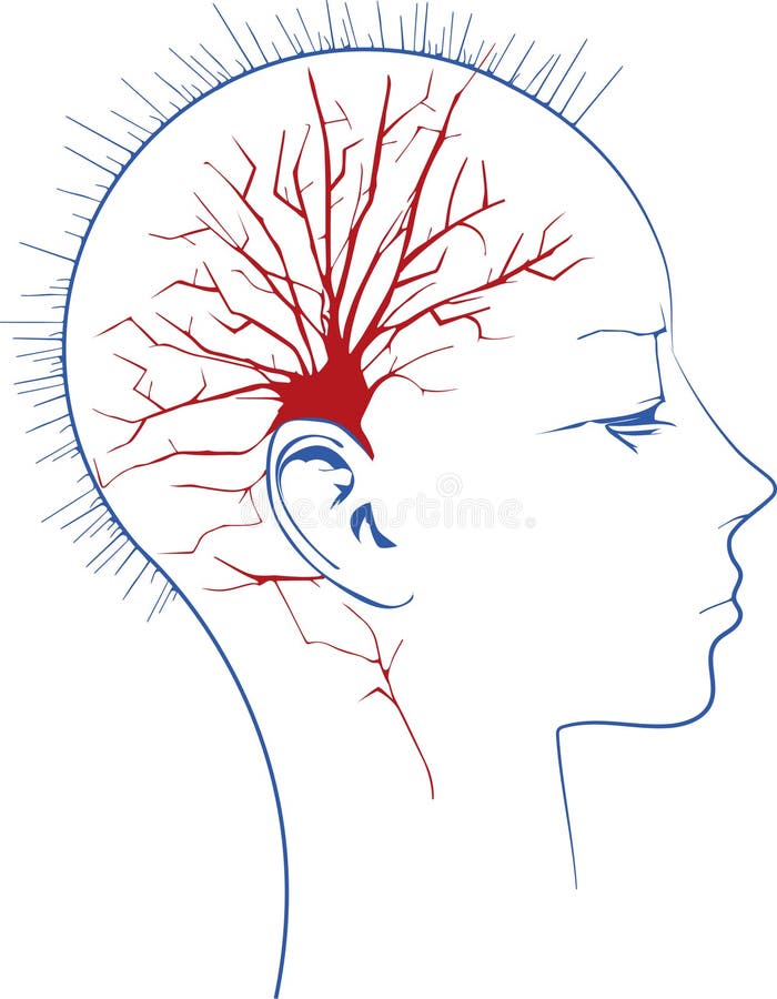 Pain in the Head, Brain and Synapses, Cognitive Problems, Mental ...
