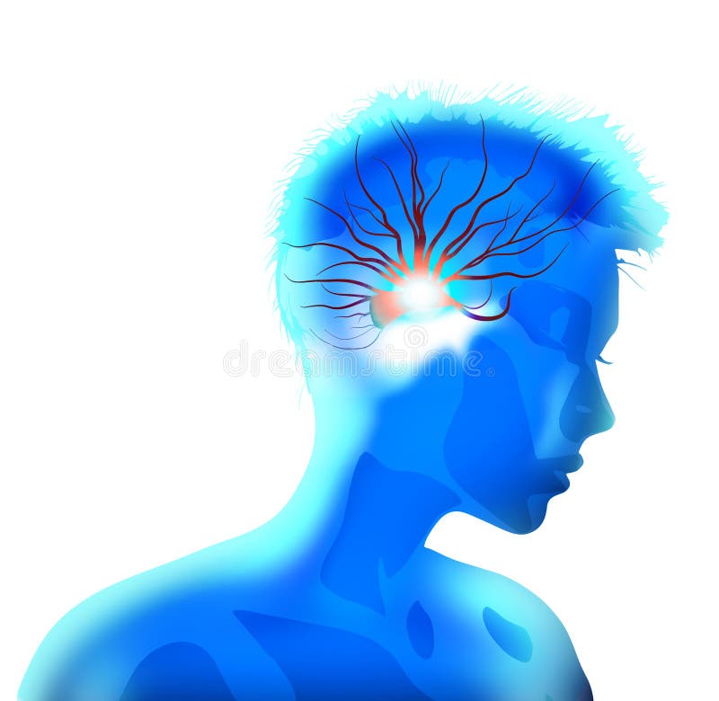 Pain in the Head, Brain and Synapses, Cognitive Problems, Mental ...