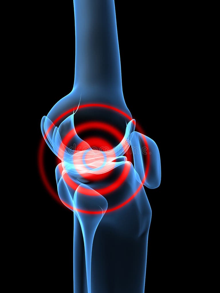 Anatomy Knee Pain Ray X Stock Illustrations – 1,166 Anatomy Knee Pain ...