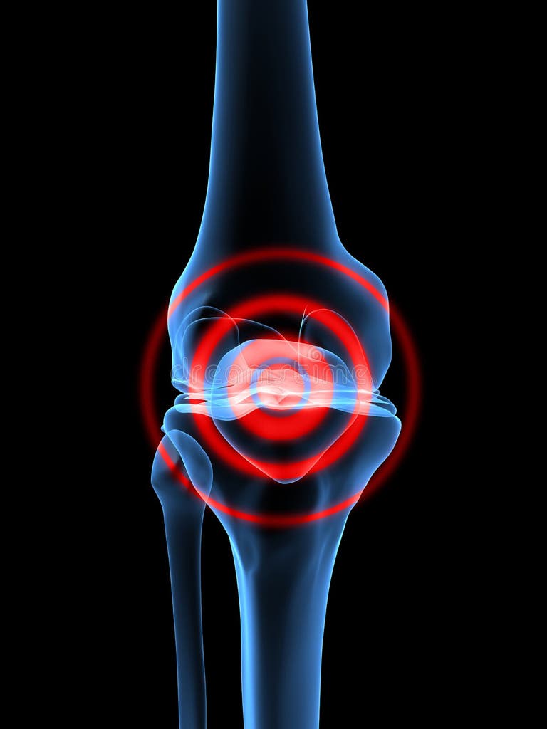 Pain Knee Anatomy Stock Illustrations – 13,137 Pain Knee Anatomy Stock ...
