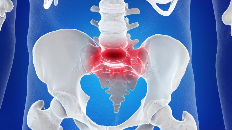 Pain in the Arthritic Knee Joint, Knee Painful, Skeleton X-ray ...