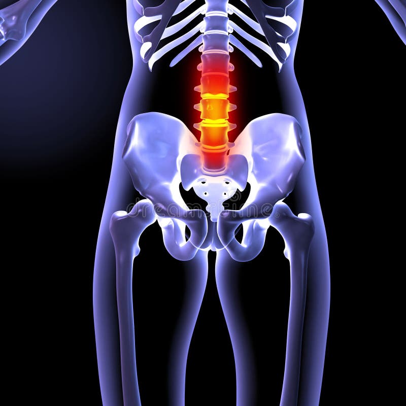 Painful back stock illustration. Illustration of illness - 27524379