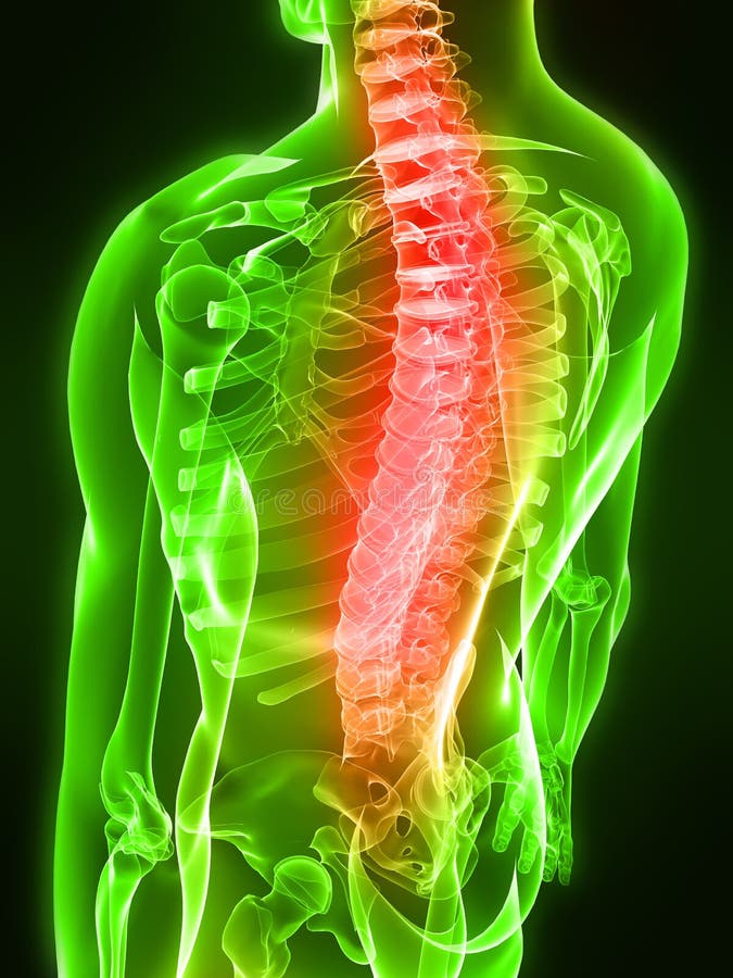 Painful back stock illustration. Illustration of graphic - 4001074