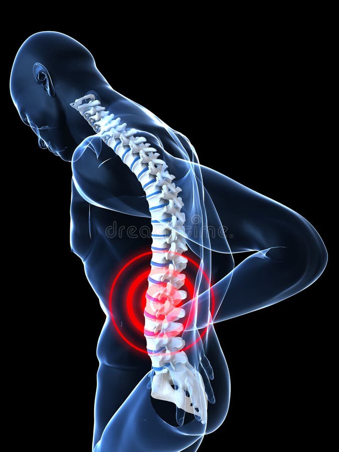 Painful back stock illustration. Illustration of painful - 8856665