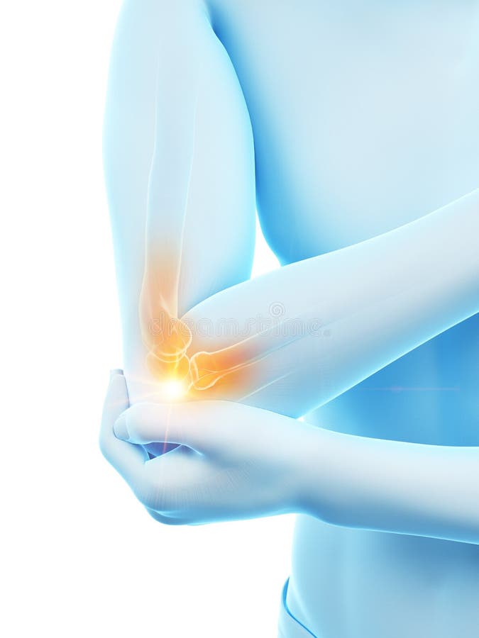 A painful elbow stock illustration. Illustration of graphic - 146960401