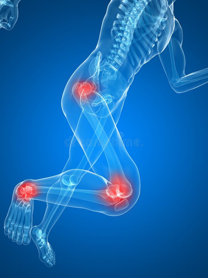 Painful joints stock illustration. Illustration of action - 11994511
