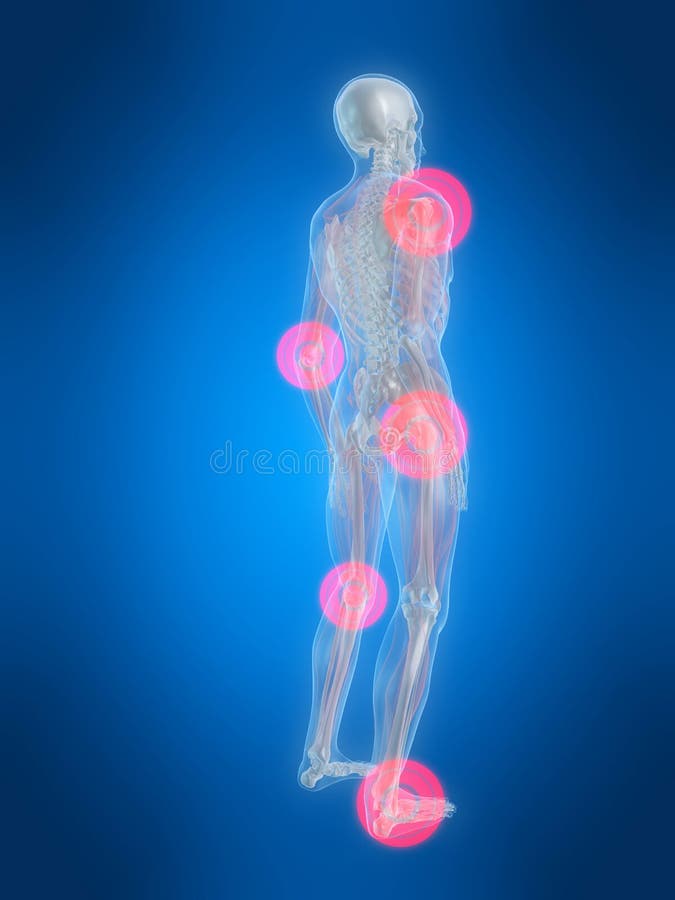 Painful joints stock illustration. Illustration of muscle - 7750562