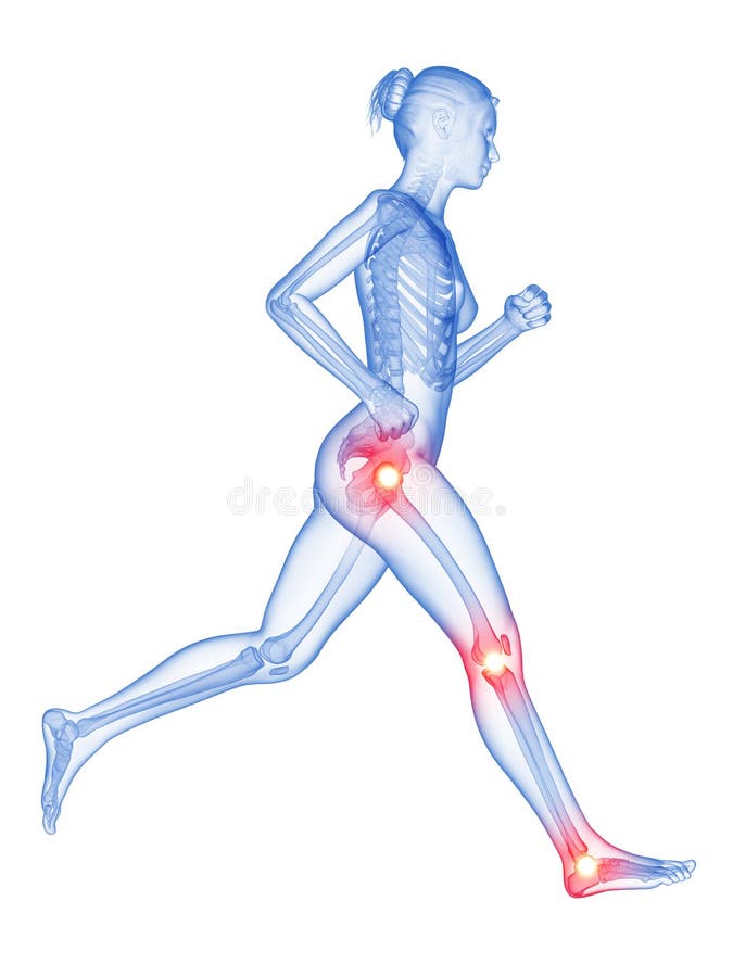 Running Skeleton - Painful Joints Stock Illustration - Illustration of ...