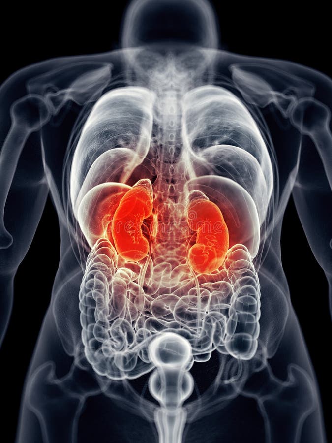 Painful kidney stock illustration. Illustration of inflamed - 57505068