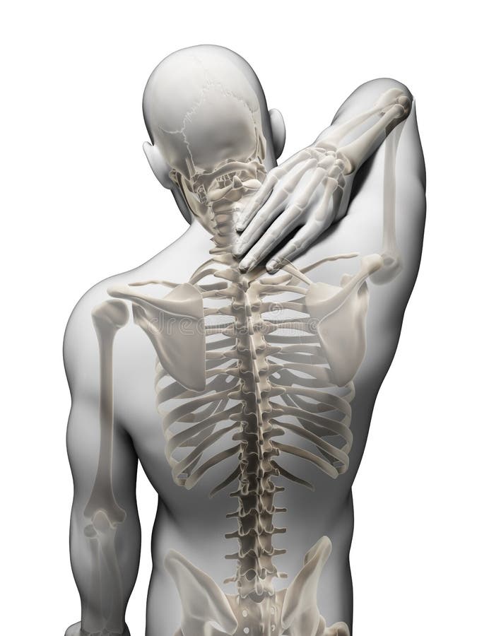 Spinal deformities stock vector. Illustration of science - 13078070