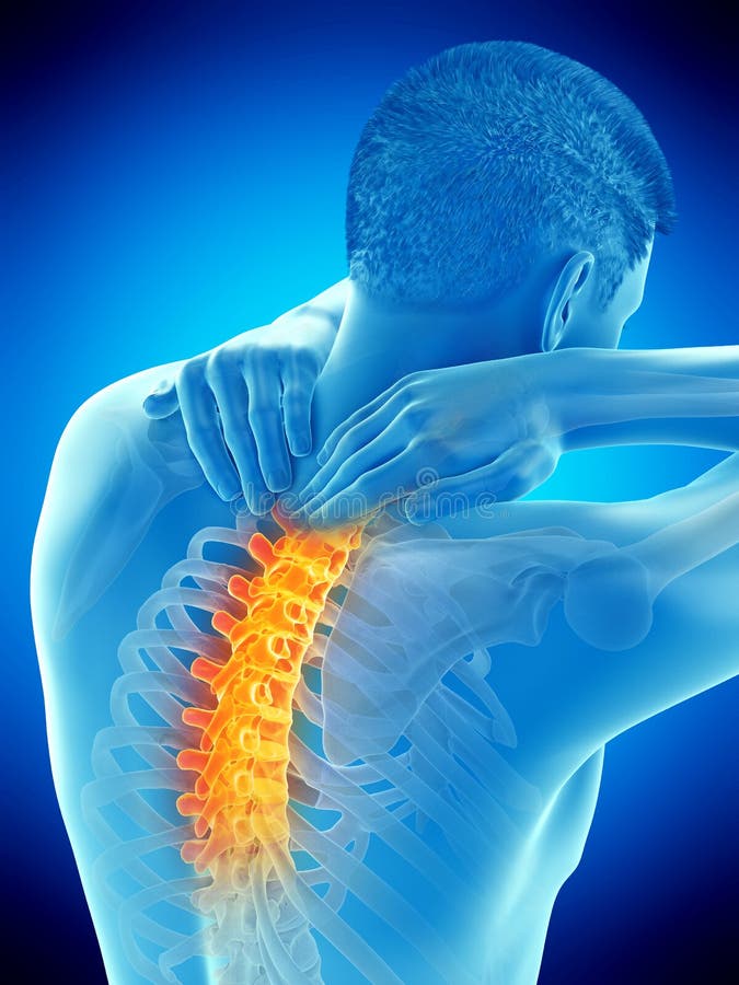 A painful upper back stock illustration. Illustration of artwork ...