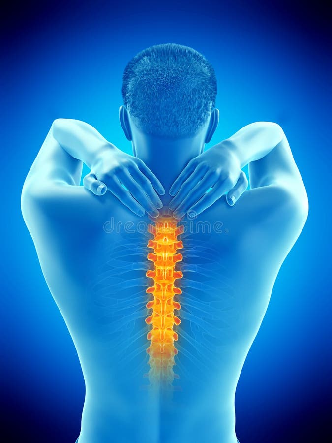 A painful upper back stock illustration. Illustration of cervical ...