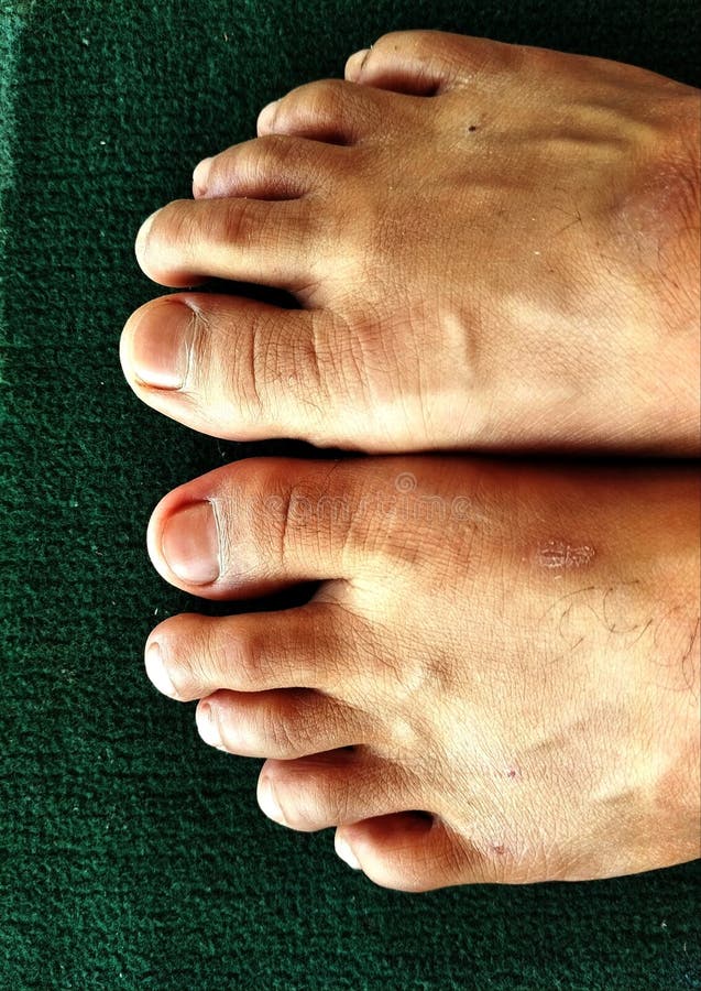 A Pair of Forelegs with Marks Against a Green Carpet Background Stock ...