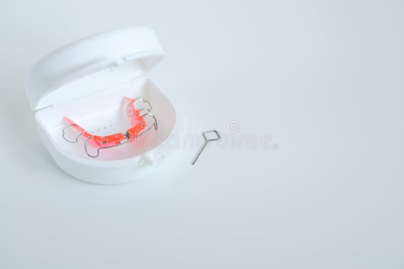 Palatal Expander with Adjustment Key Stock Image - Image of correction ...