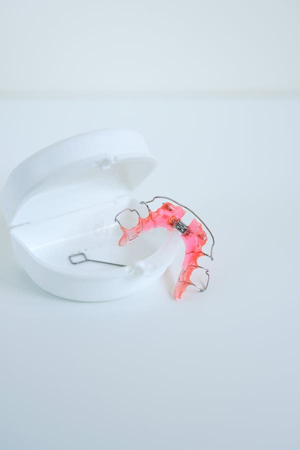 Palatal Expander with Adjustment Key Stock Image - Image of palatal ...