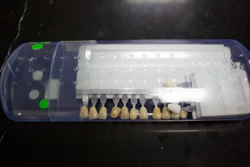 Palette of Shades of Teeth at a Dentist Office. Dental Color Samples ...