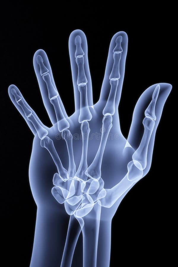 Hand xray stock illustration. Illustration of hospital - 16930669