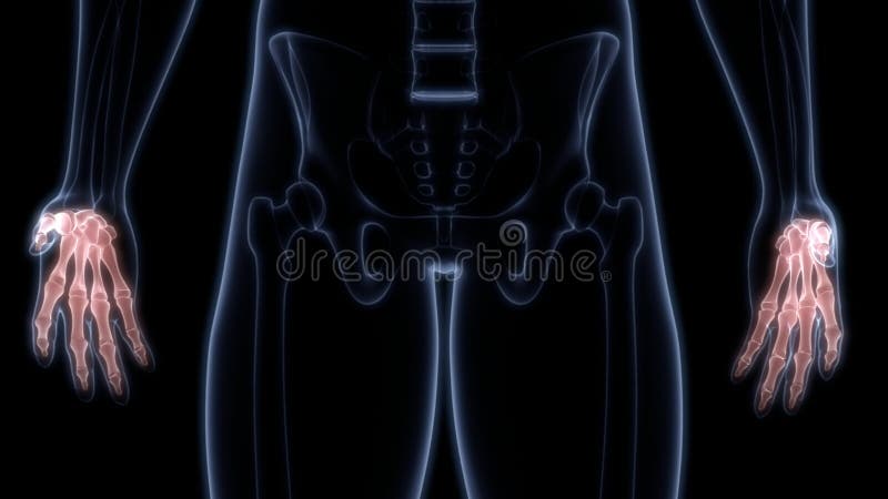 Palm Hand Bone Joints of Human Skeleton System Anatomy X-ray 3D ...