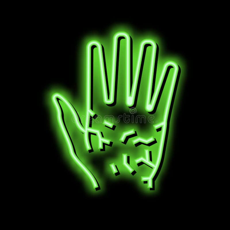 Palms Dry Skin Neon Glow Icon Illustration Stock Vector - Illustration ...