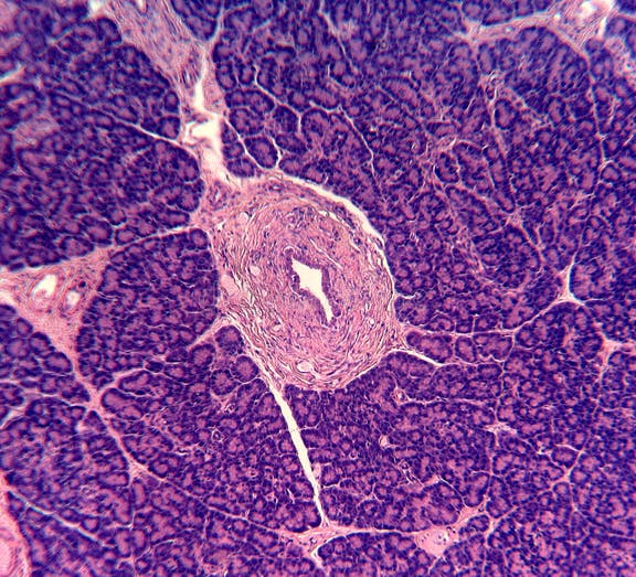 Pancreatic duct stock photo. Image of cell, islets, microscope - 6166766