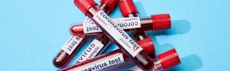 Panoramic Shot of Test Tubes with Blood Samples and Coronavirus Test ...