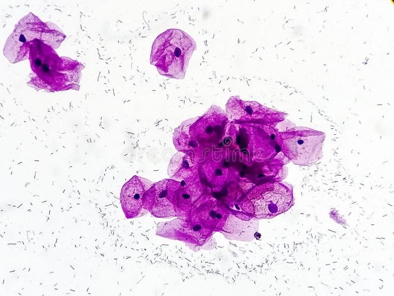 Pap Smear Vaginosis Stock Photos - Free & Royalty-Free Stock Photos ...