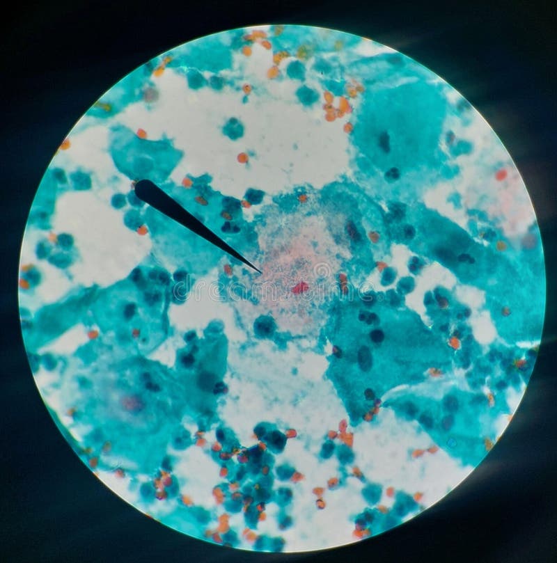 Ginecologia Dibujos Stock Photos - Free & Royalty-Free Stock Photos ...