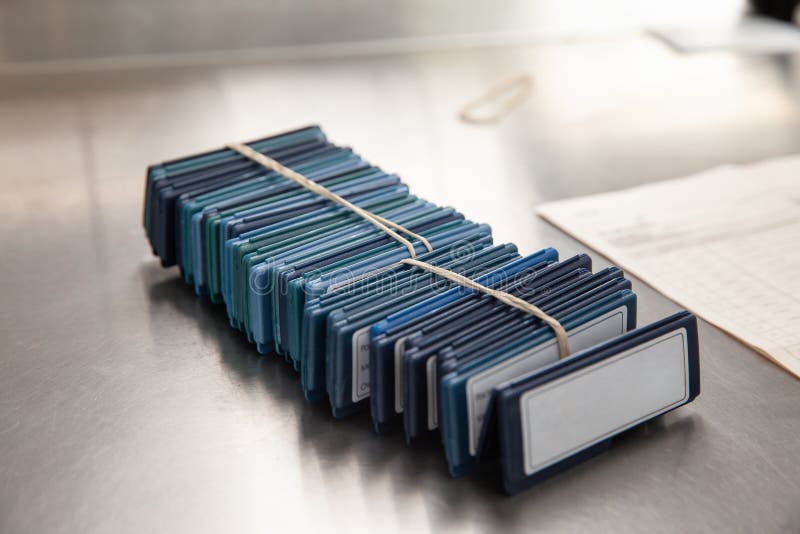 Pap Smear Samples in the Laboratory for Analysis. Patient Samples for ...