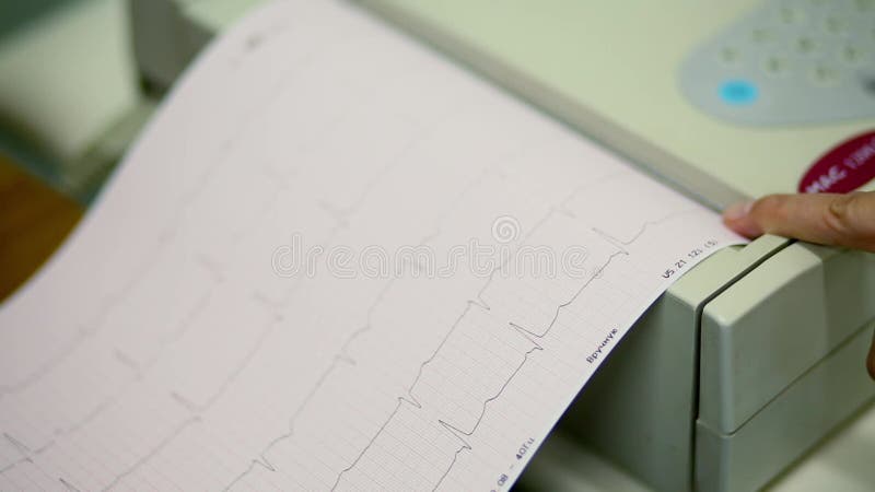 Paper with Electrocardiogram Goes from Printer of Stock Footage - Video ...