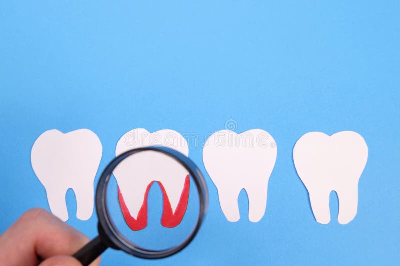 Paper Teeth with Root Inflammation, Dental Care Concept, Dental ...