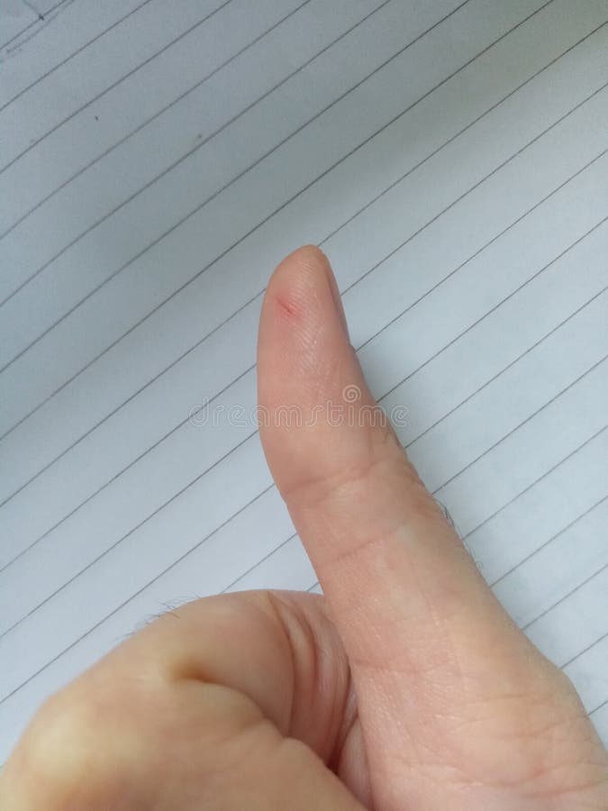 Papercut on Thumb of Right Hand Stock Photo - Image of painful, thumb ...