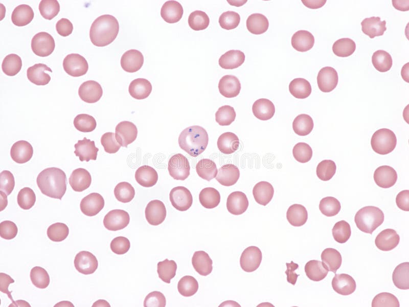 Basophilic Inclusions Stock Photos - Free & Royalty-Free Stock Photos ...