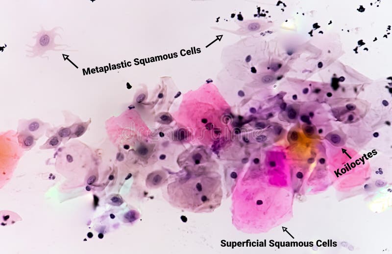 Hpv Related Cartoon Stock Photos - Free & Royalty-Free Stock Photos ...